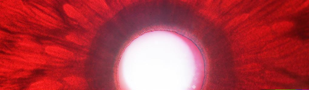 eyeGENE Home | eyeGENE